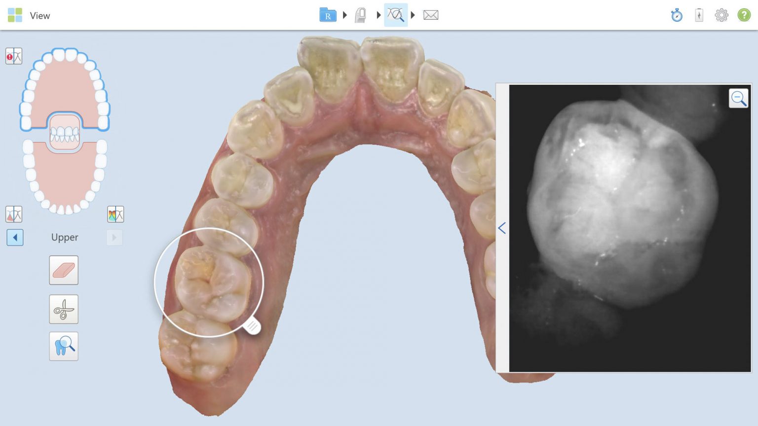 iTero Element—Digital Intraoral Scanner - Dental Reflections Dublin